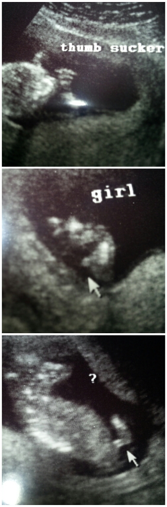 Update 19 week scan... guesses pleeeease