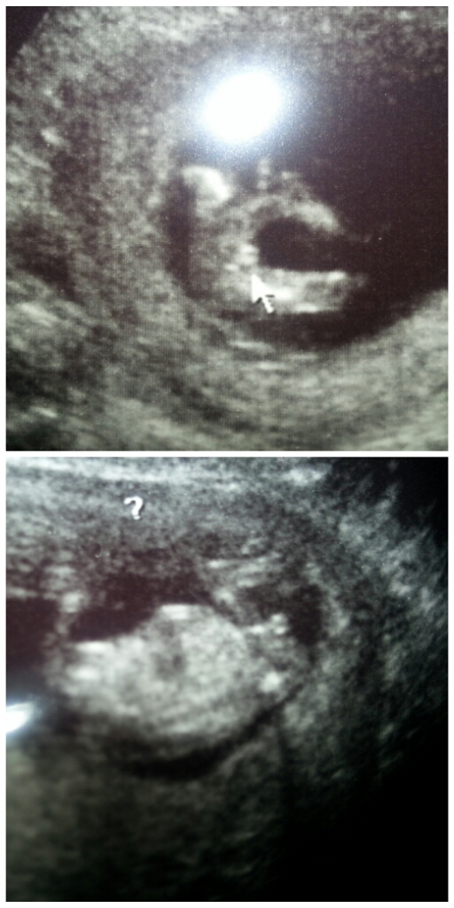 Update 19 week scan... guesses pleeeease