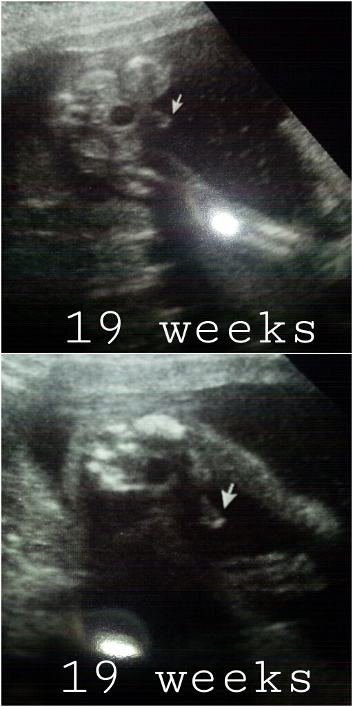 Update 19 week scan... guesses pleeeease