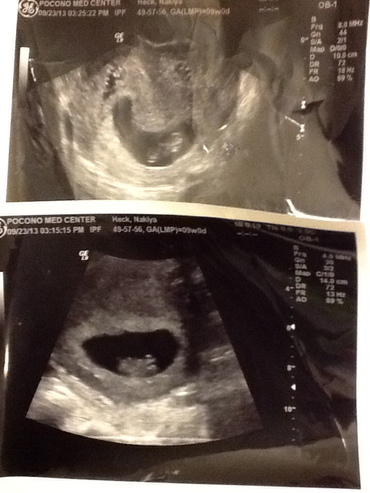 Ramzi's Method - Page 9