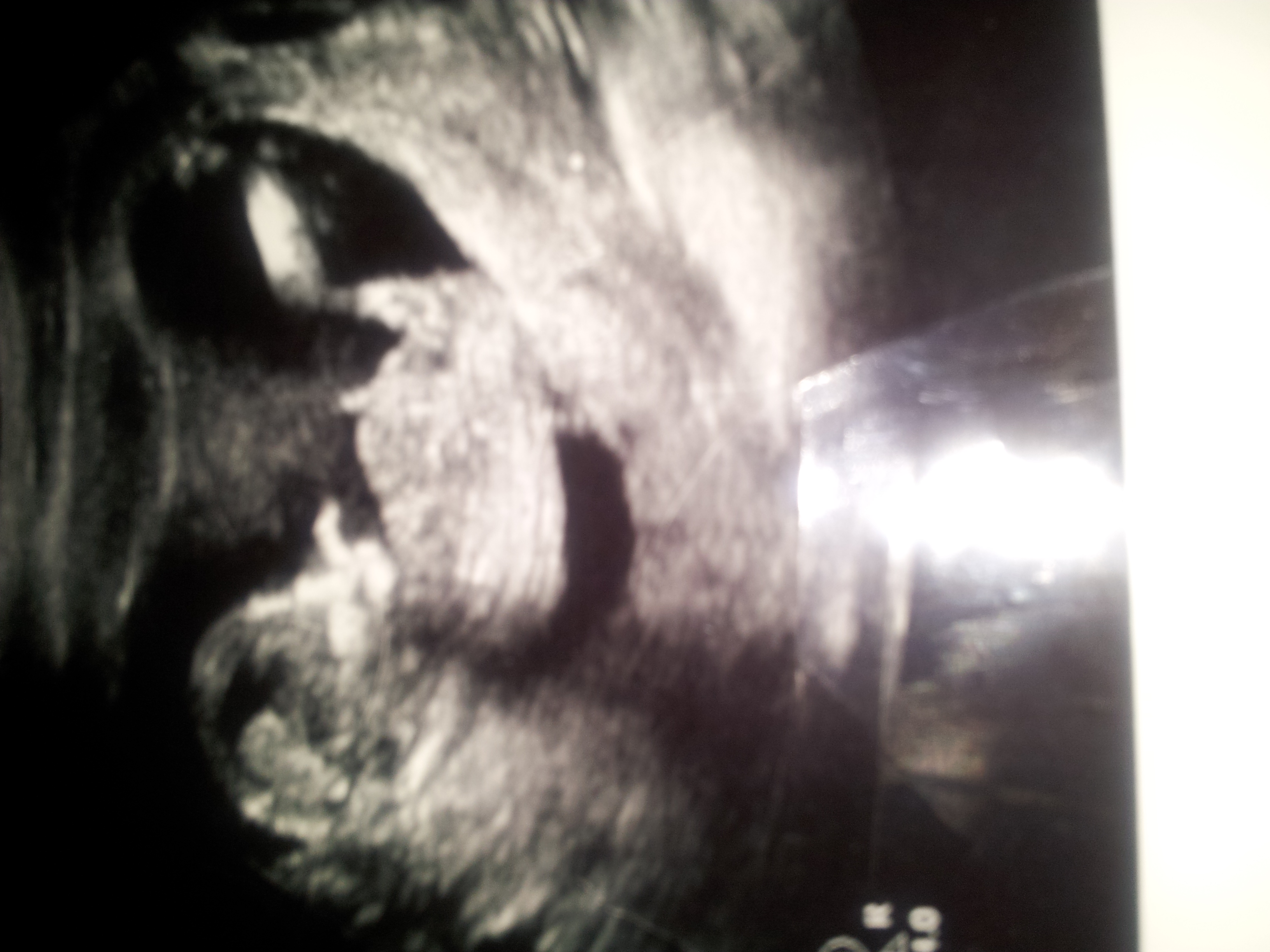 13w4d nub guess please....