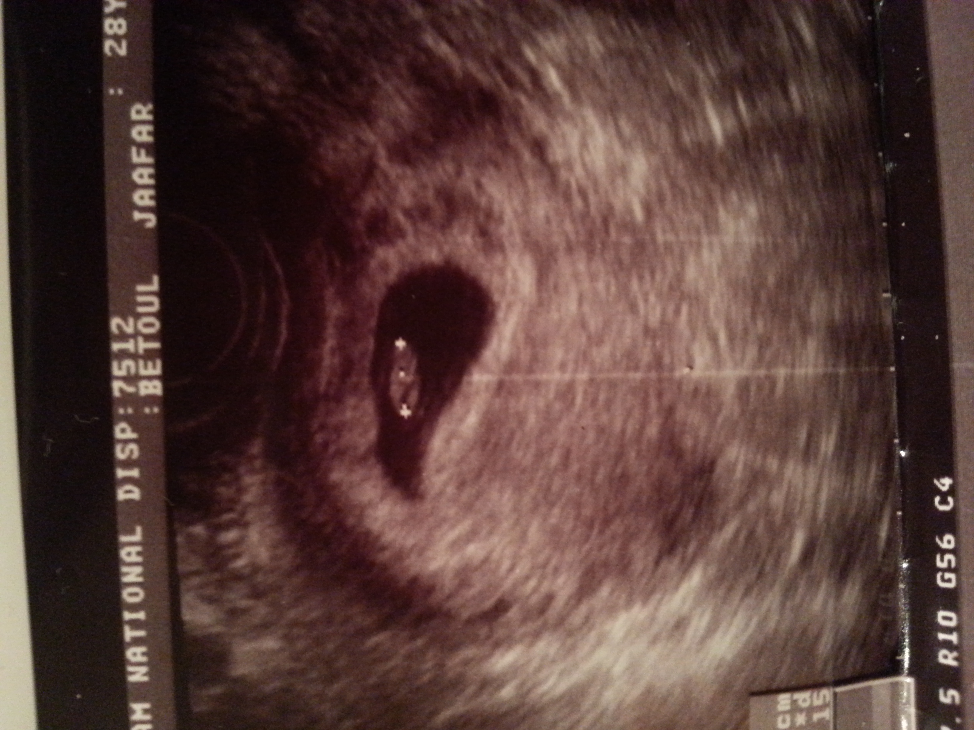 How accurate is Ramzi theory? - Page 2