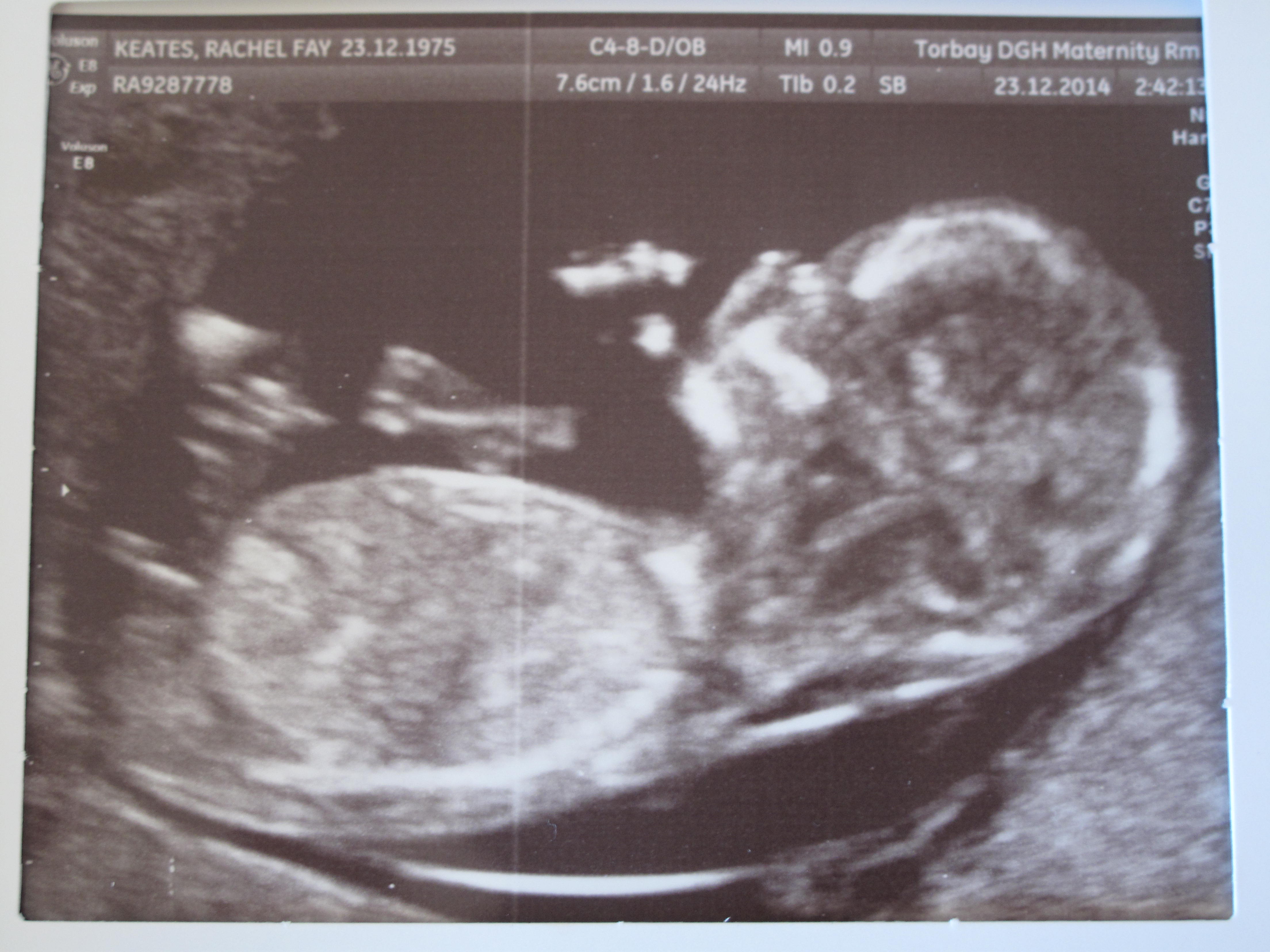 12+4 week scan guesses please ladies.....