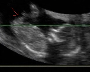 16w6d potty shots from 3d scan - Page 3