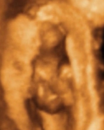 16w6d potty shots from 3d scan - Page 3