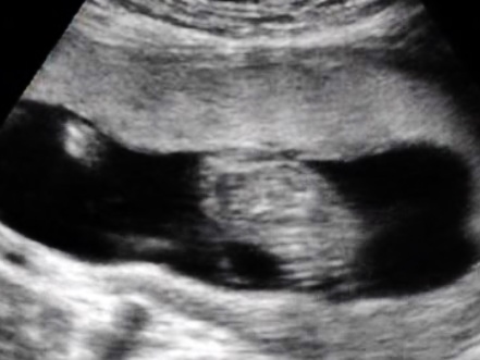 16w6d potty shots from 3d scan - Page 3