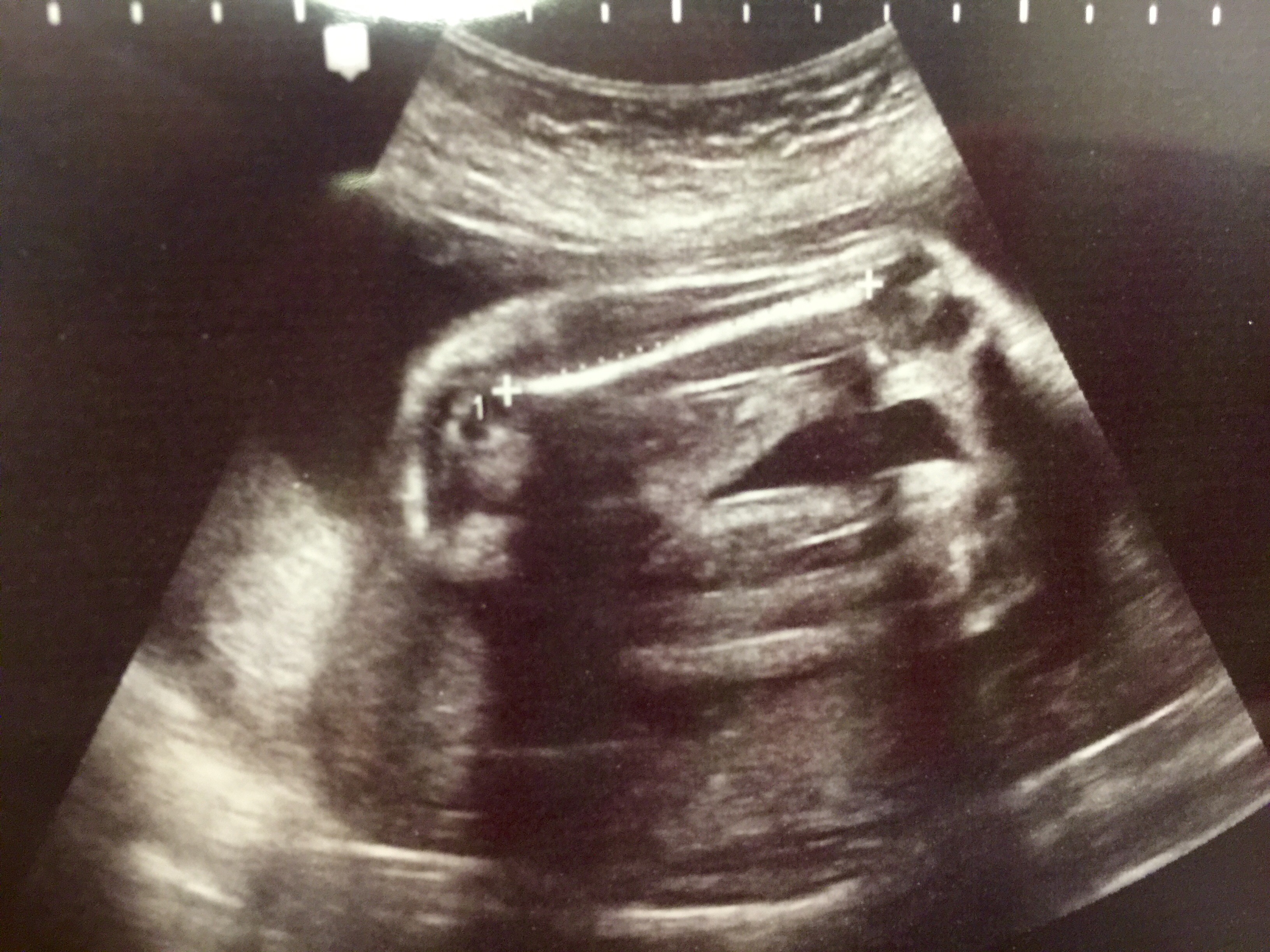 27 week scan, would appreciate some predictions please :-)