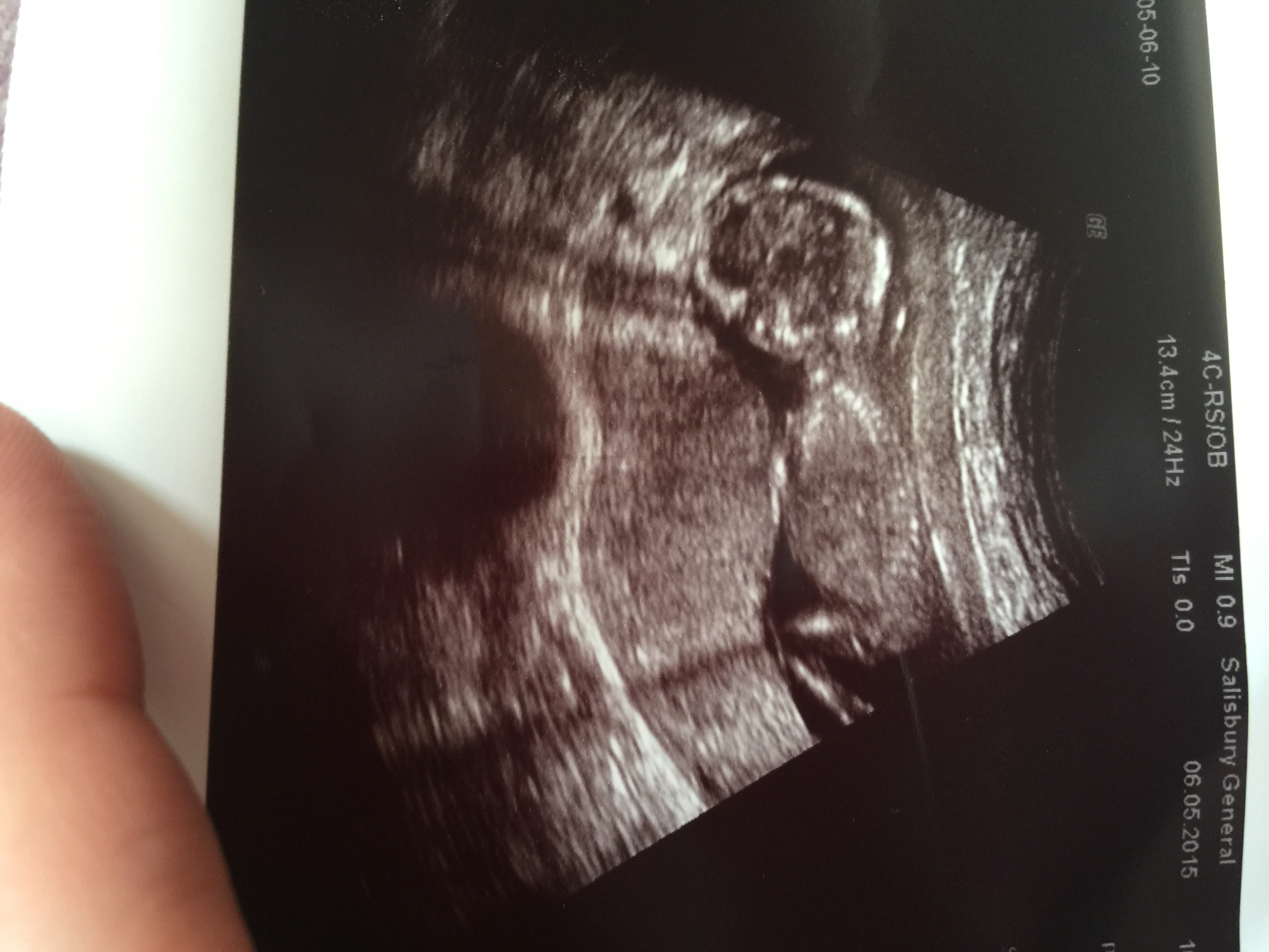14 week scan picture, any clues?