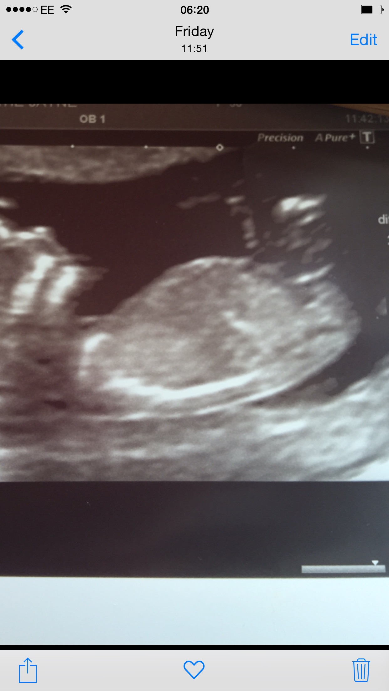 14 week scan picture, any clues?