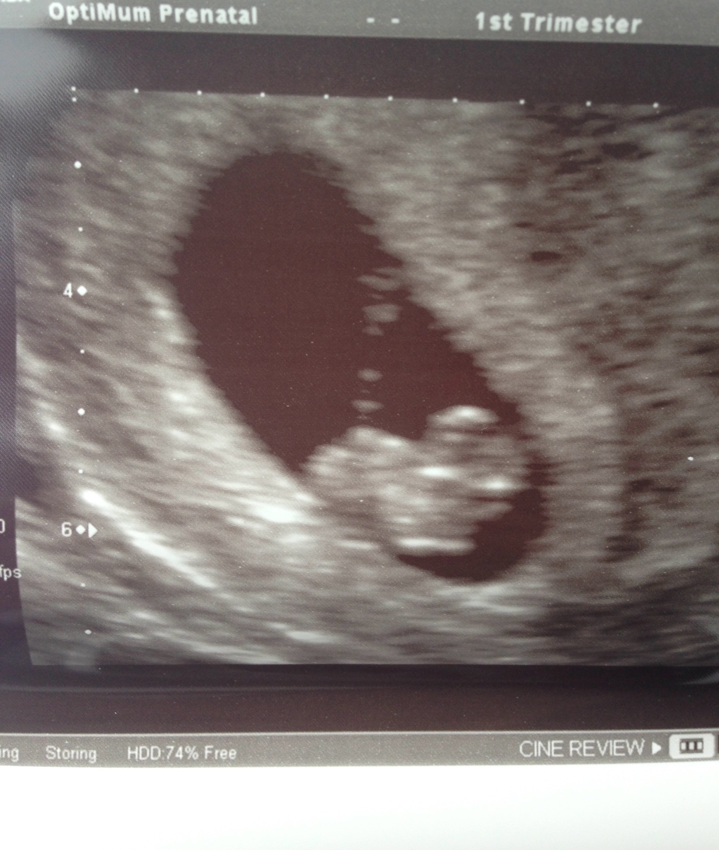 Ramzi's Method - Page 21