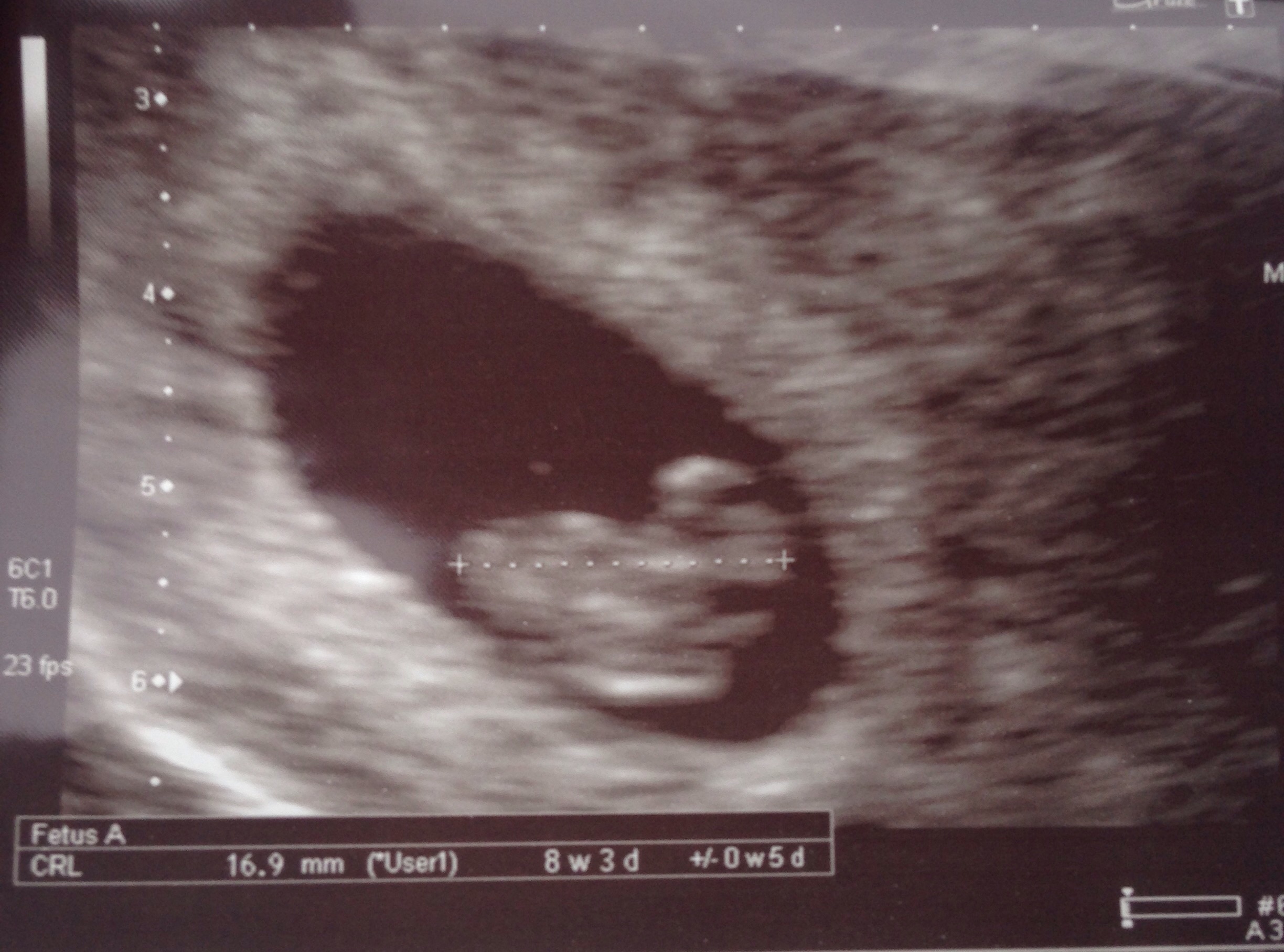 Ramzi's Method - Page 22