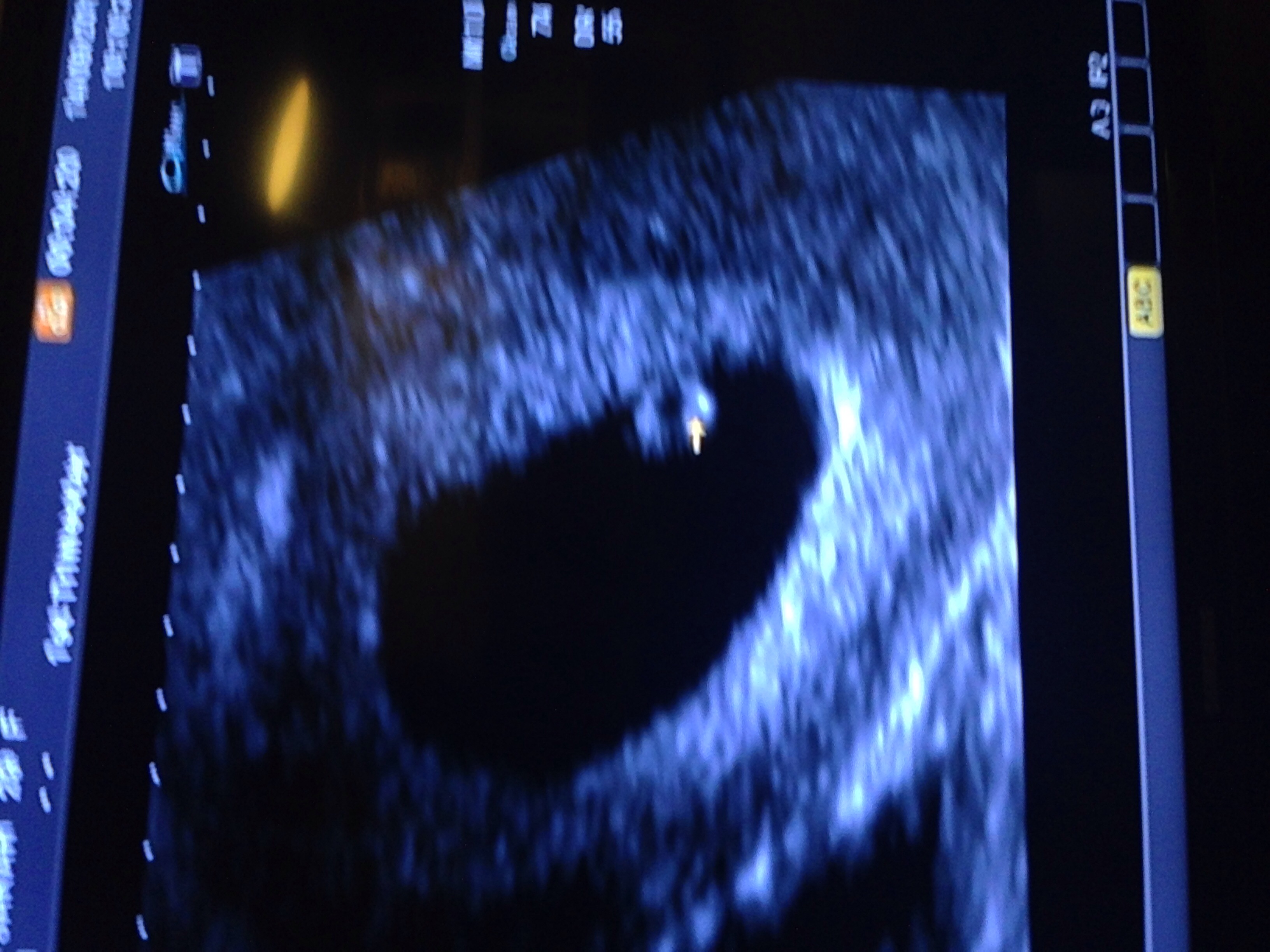 Ramzi's Method - Page 22