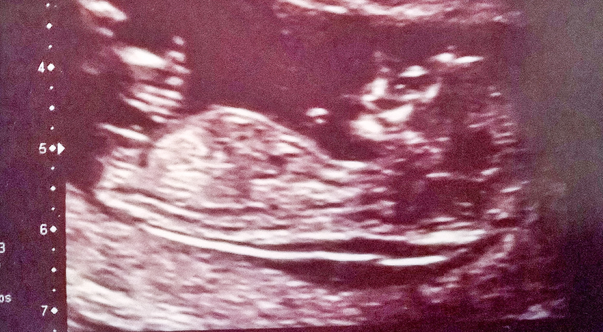 12 week scan guesses please