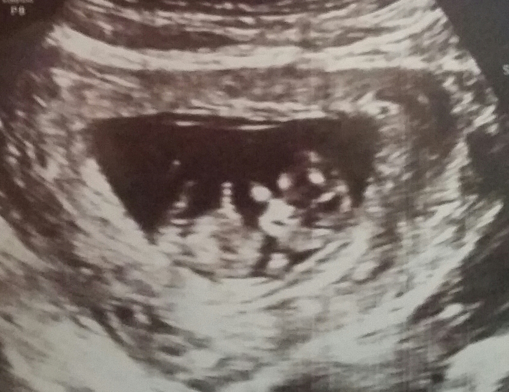 12 week scan! What do you think?
