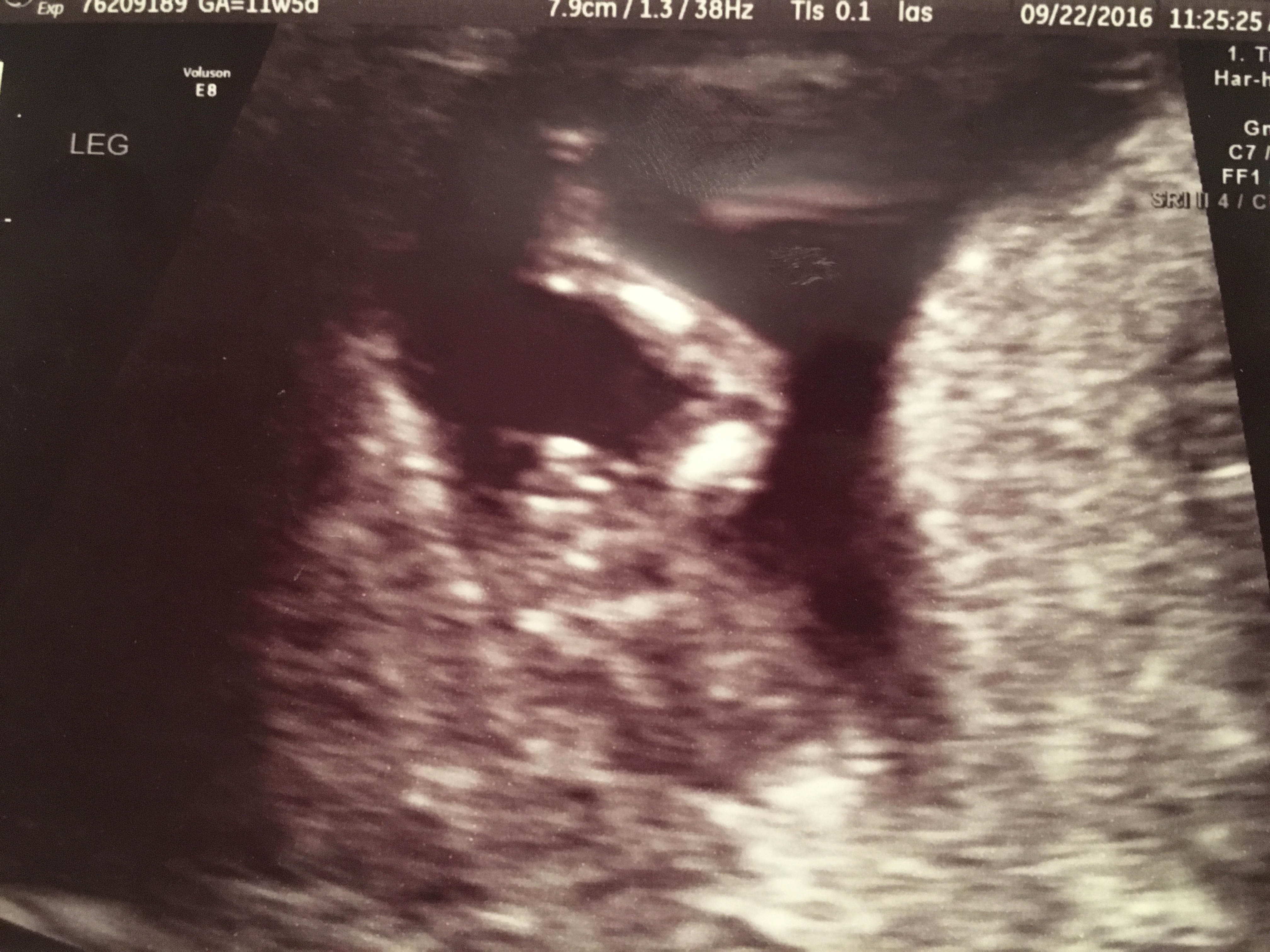 Are these boy parts?