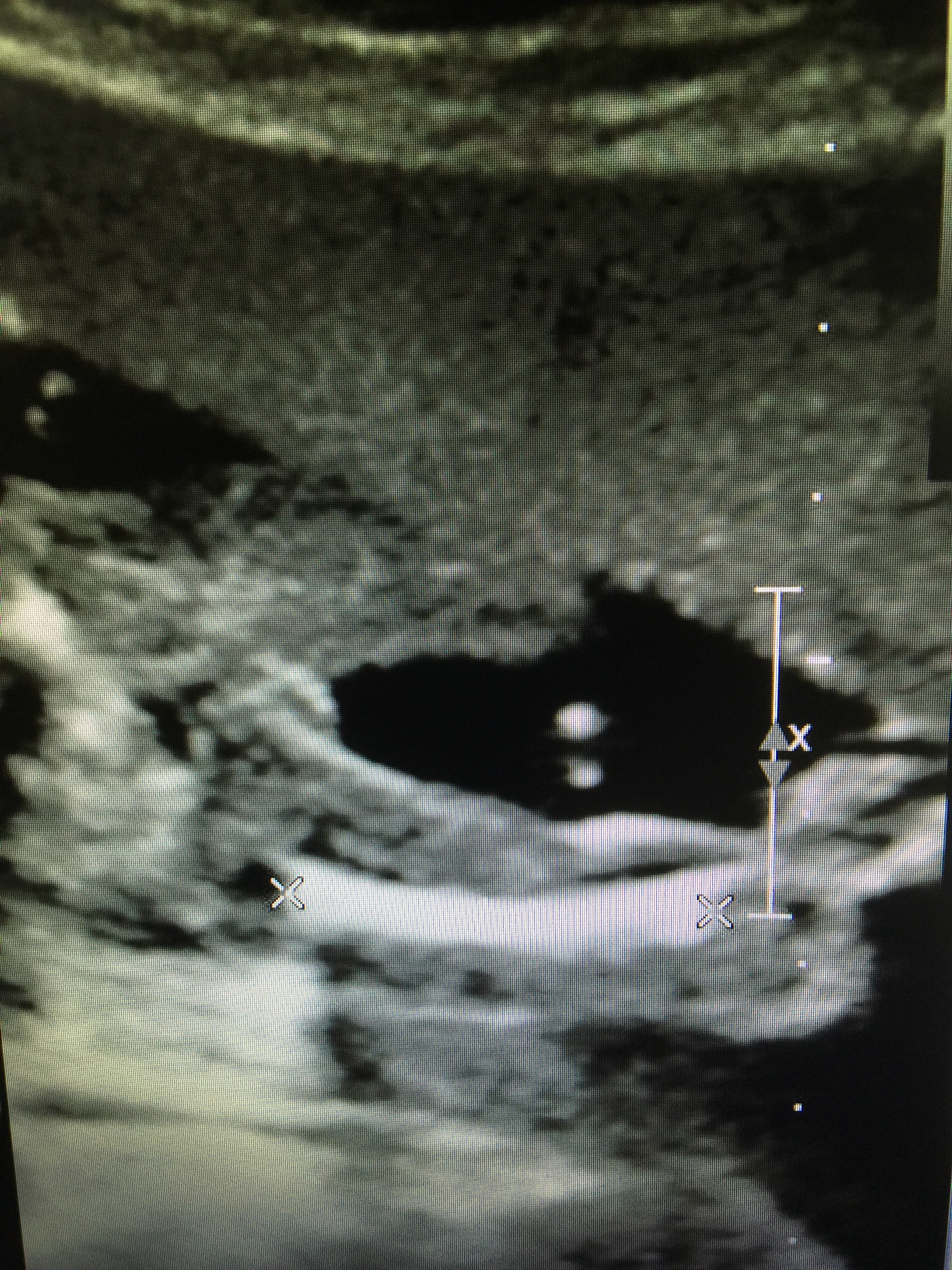 19 Week Scan and also 12W2D scan included