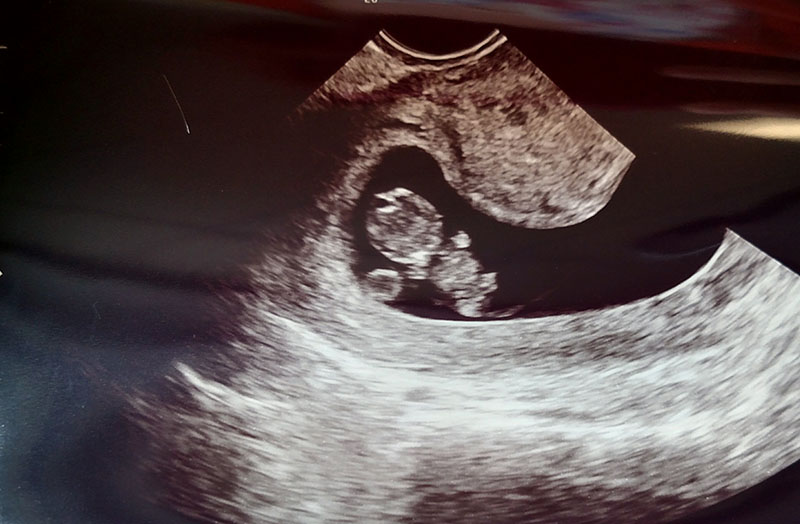 Ramzi Method - 8 weeks