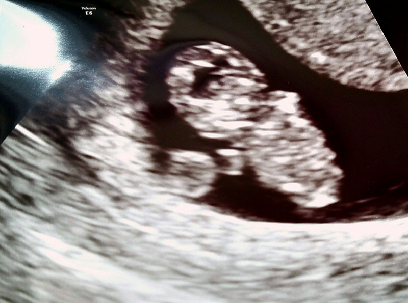 Ramzi Method - 8 weeks