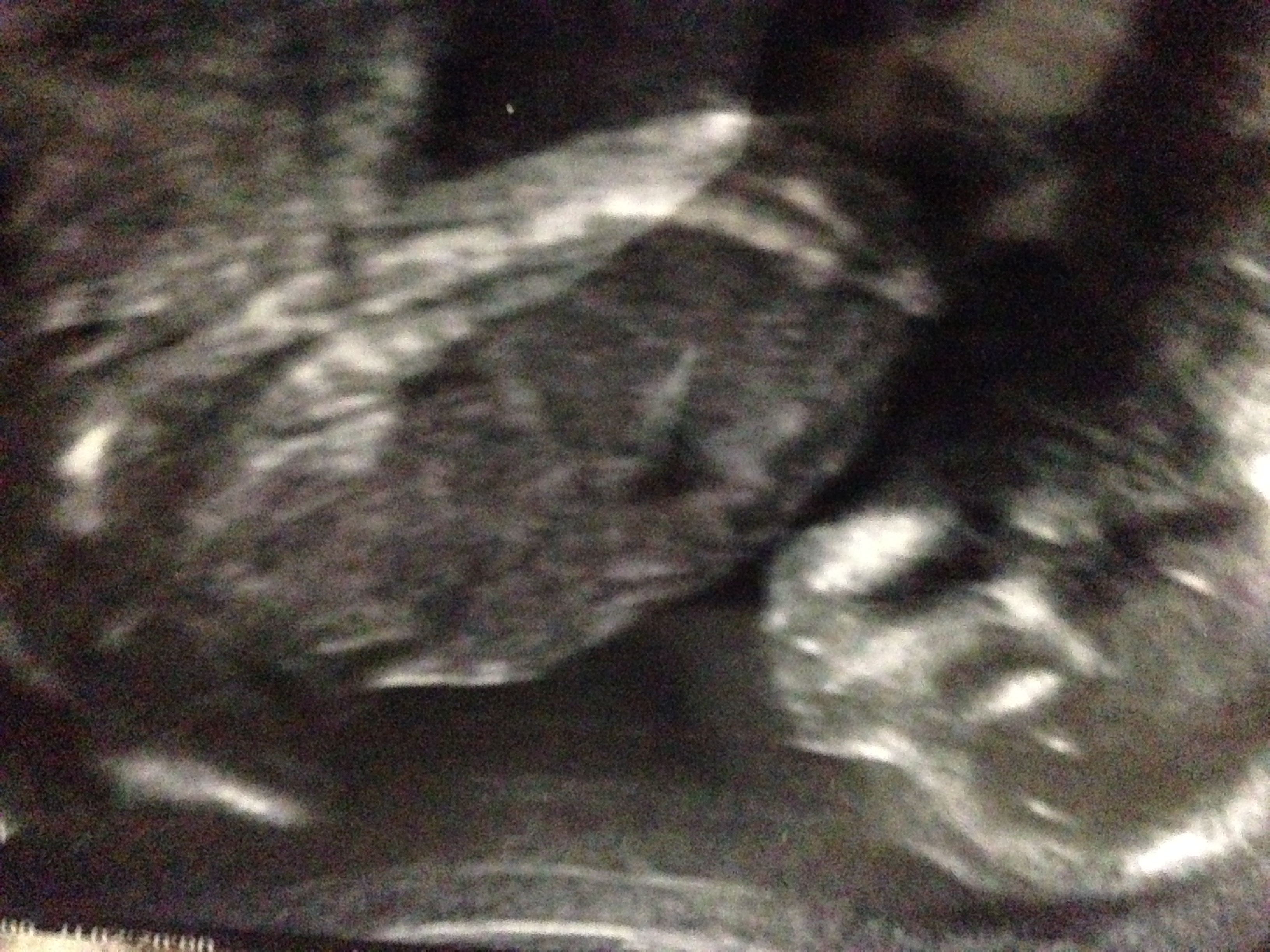 13 and 17 week scans- and gender clues?
